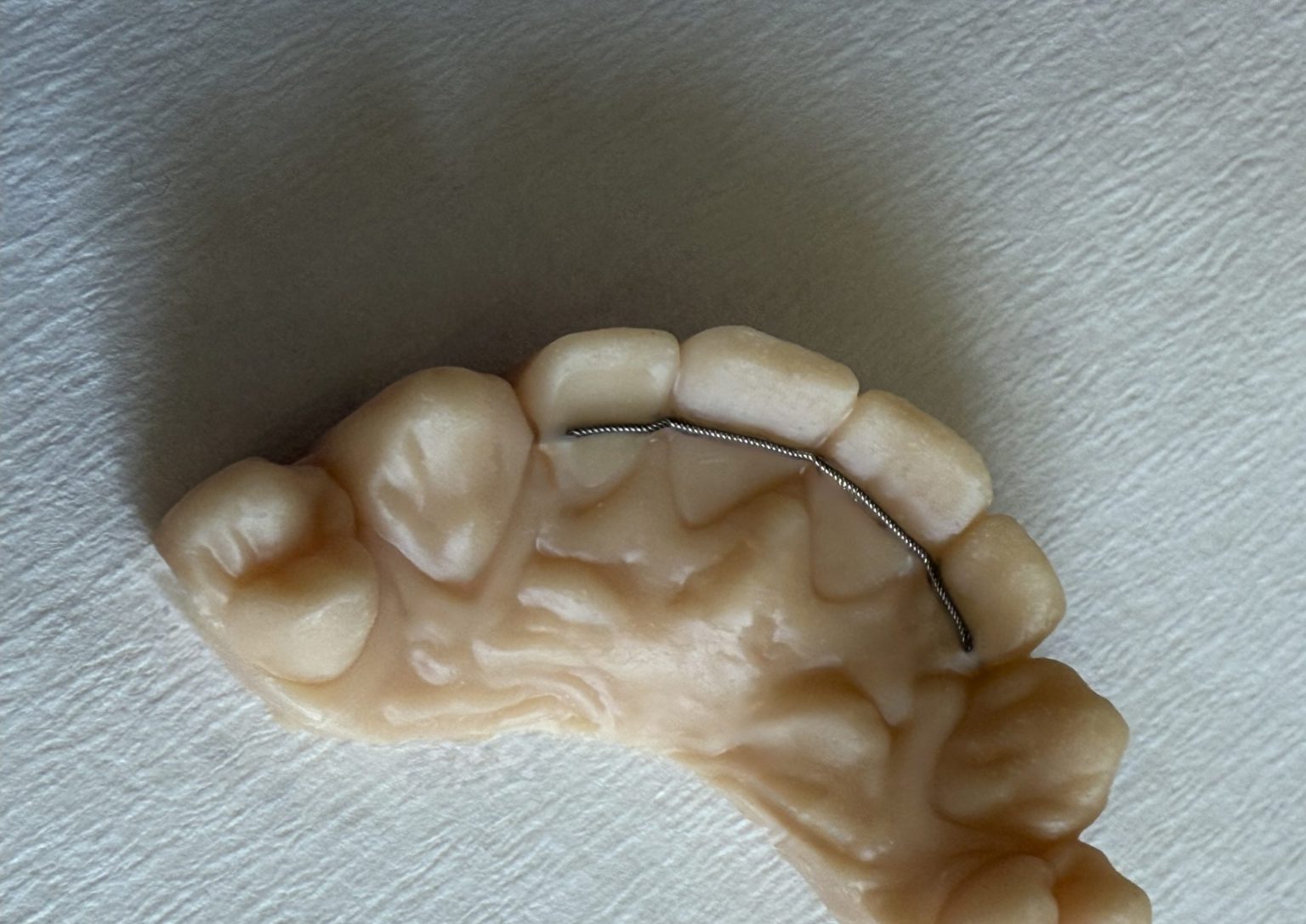 Retainers – Ipswich Ortho