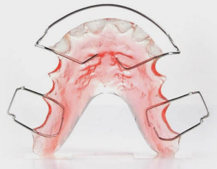 Removable Braces – Ipswich Ortho